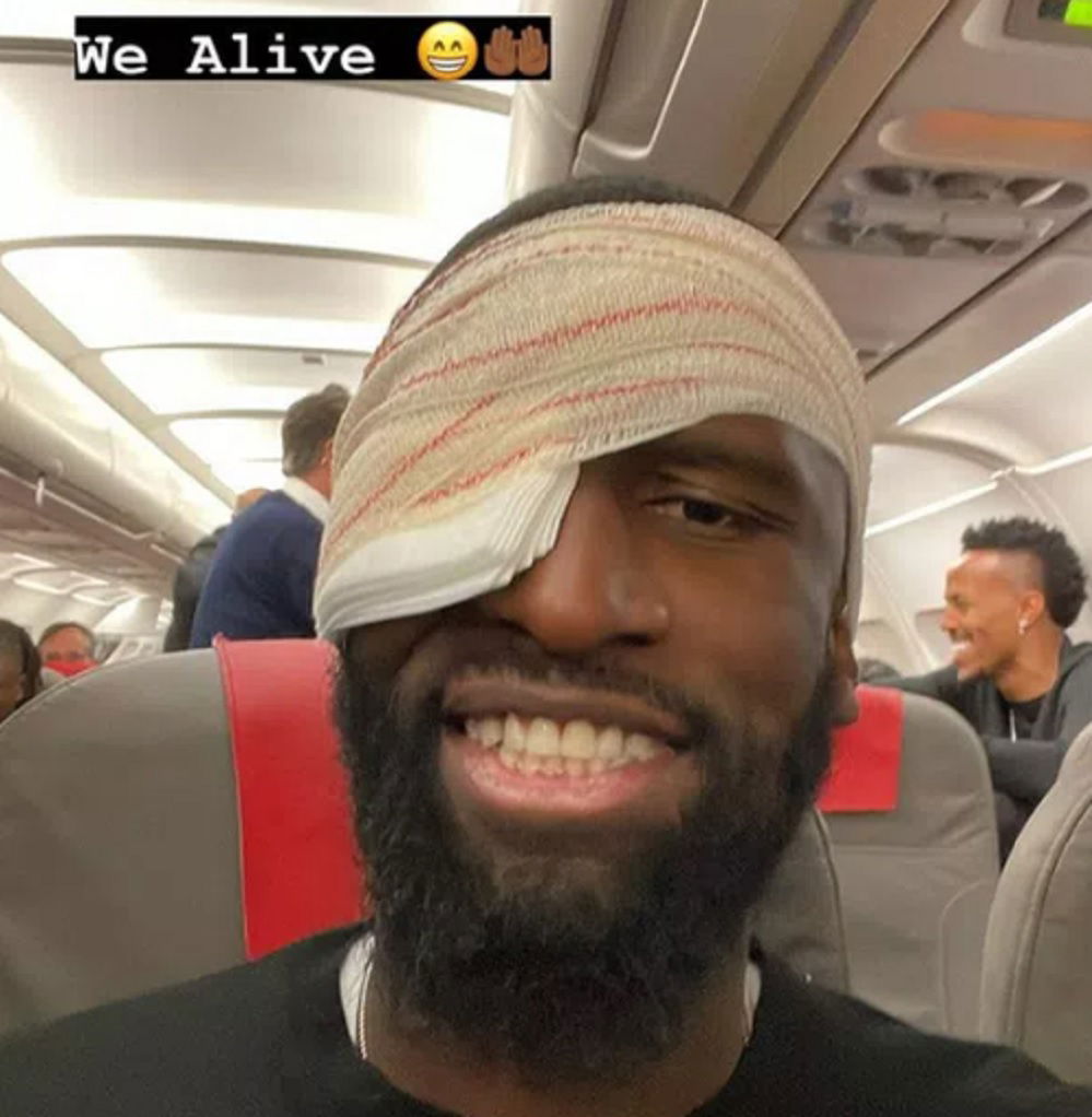 Rudiger sorride sui social dopo la paura e 20 punti di sutura: "Sono ...