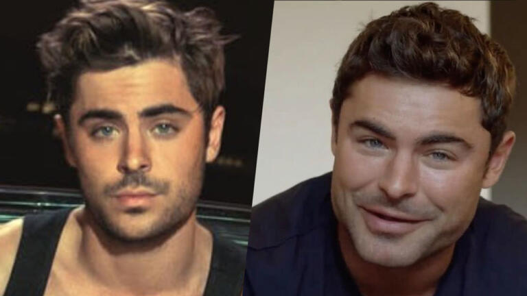 Zac Efron e la chirurgia: l'attore spiega come mai è cambiato il suo volto
