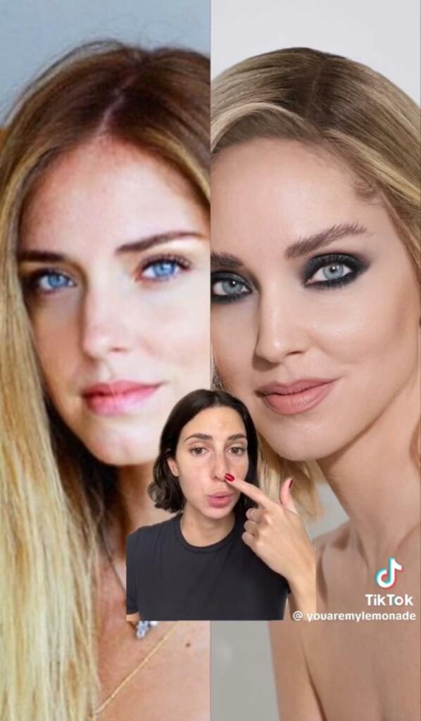 Botox e filler per Chiara Ferragni, parla l'esperta e mostra il prima e ...