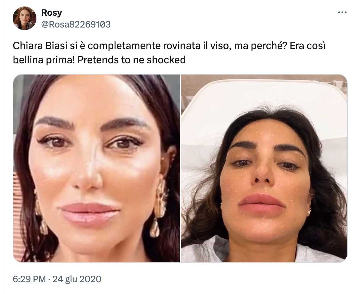Chiara Biasi rimuove il filler dal volto: "Ero un mostro"