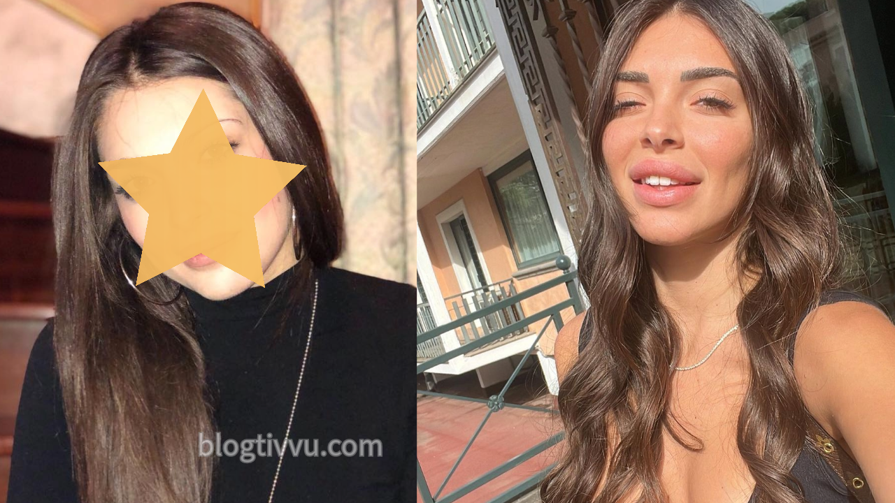 Greta Rossetti prima e dopo la chirurgia: il video e le foto a confronto