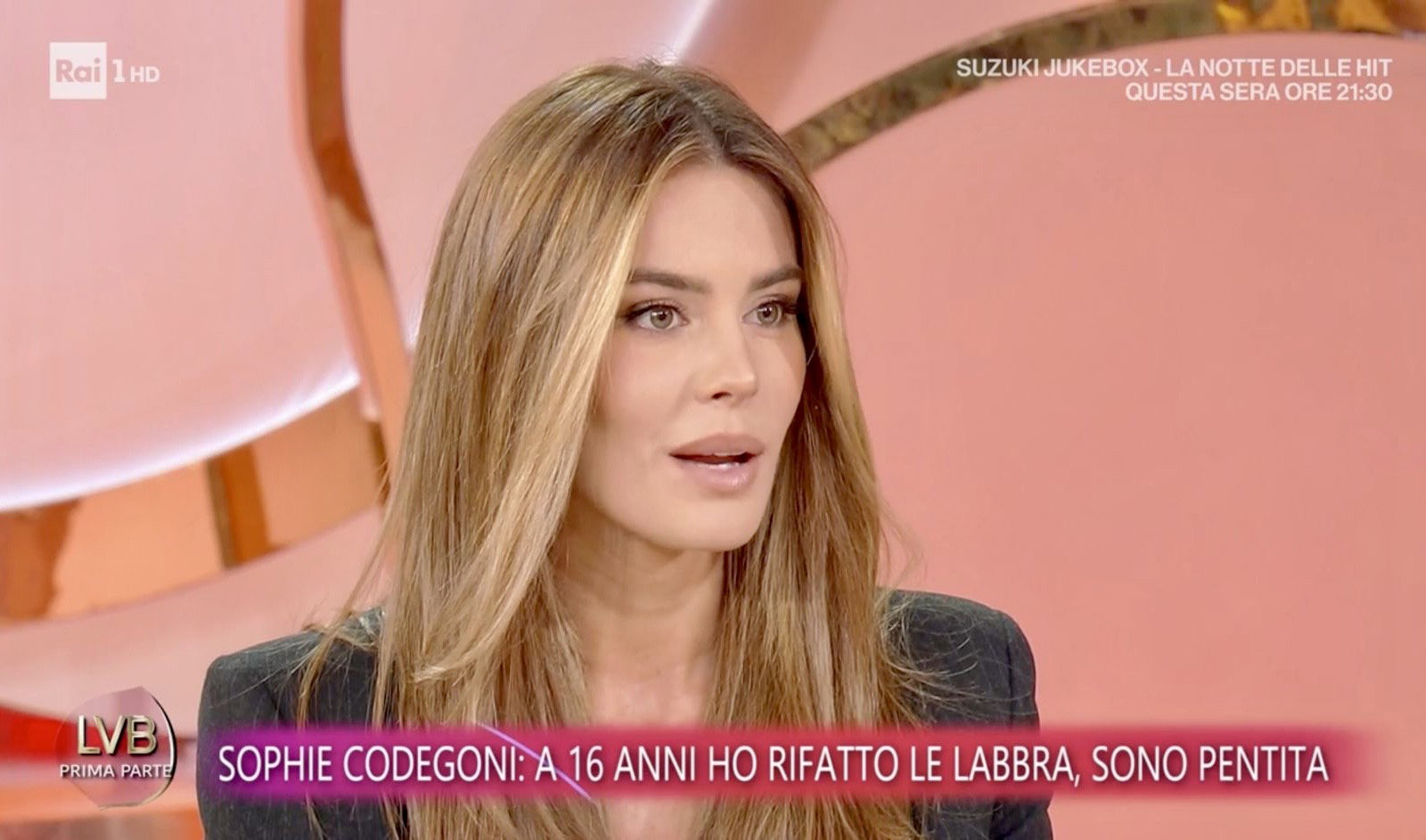 Sophie Codegoni spiega perché si è pentita di aver fatto ricorso alla chirurgia estetica: “Era ...