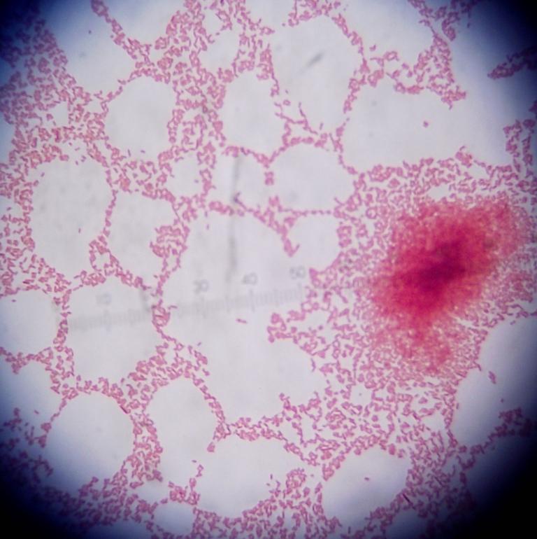 Serratia marcescens: come si trasmette il batterio degli ospedali ...